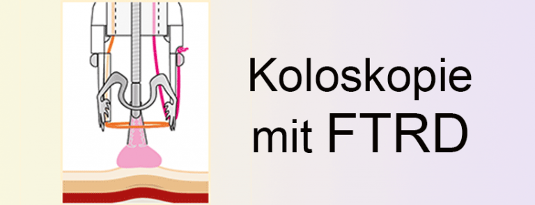 Koloskopie und FTRD – perimed Fachbuch Verlag